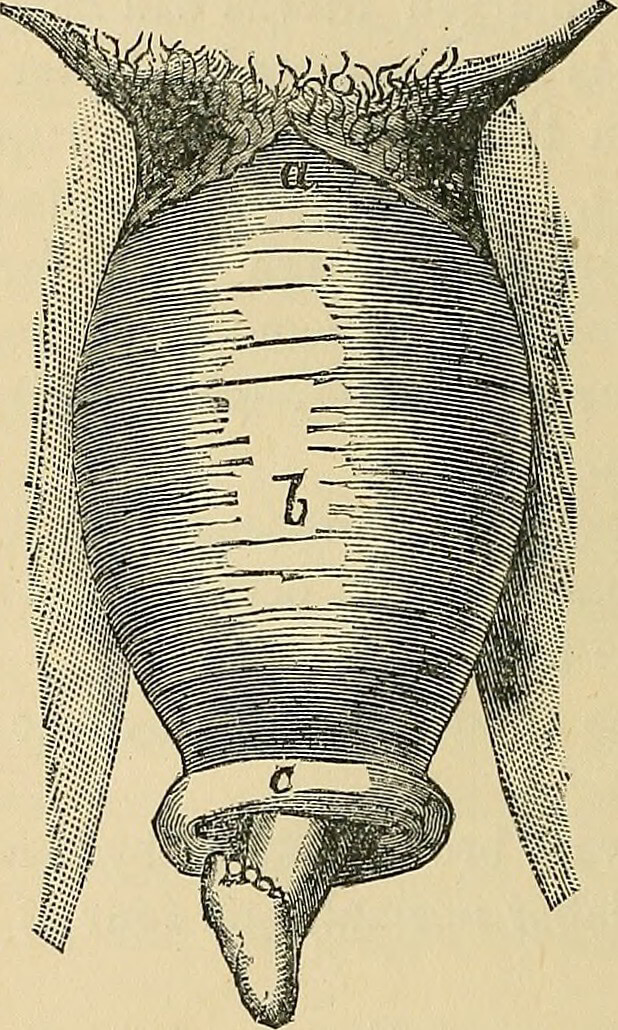 Prolapse Of The Uterus Symptoms And Measures Earths Lab The Easy Way To Learn
