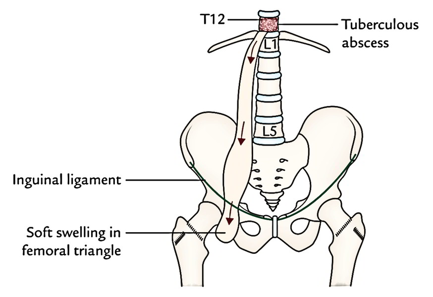 Easy Notes On 【Psoas Major】Learn in Just 4 Minutes!