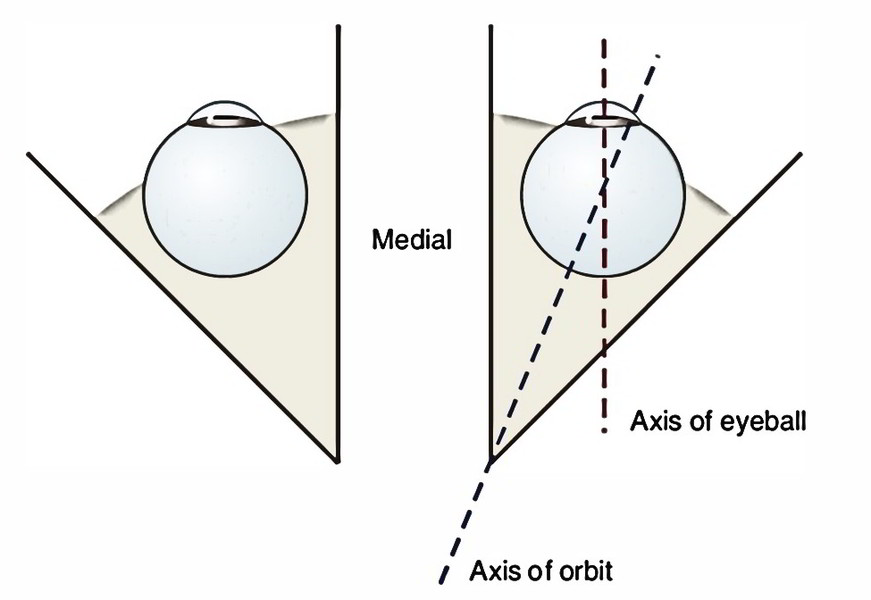 Easy Notes On 【Extraocular Muscles】Learn in Just 4 Minutes!