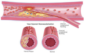Vasa Vasorum – Earth's Lab