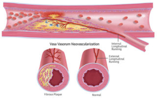 Vasa Vasorum – Earth's Lab