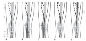 Popliteal Vein – Earth's Lab